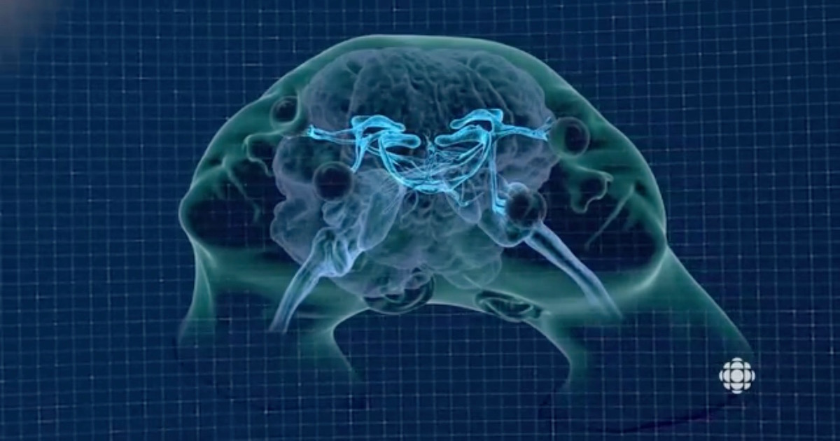 What the Craniopagus Twins Teach Us About the Mind and the Brain ...