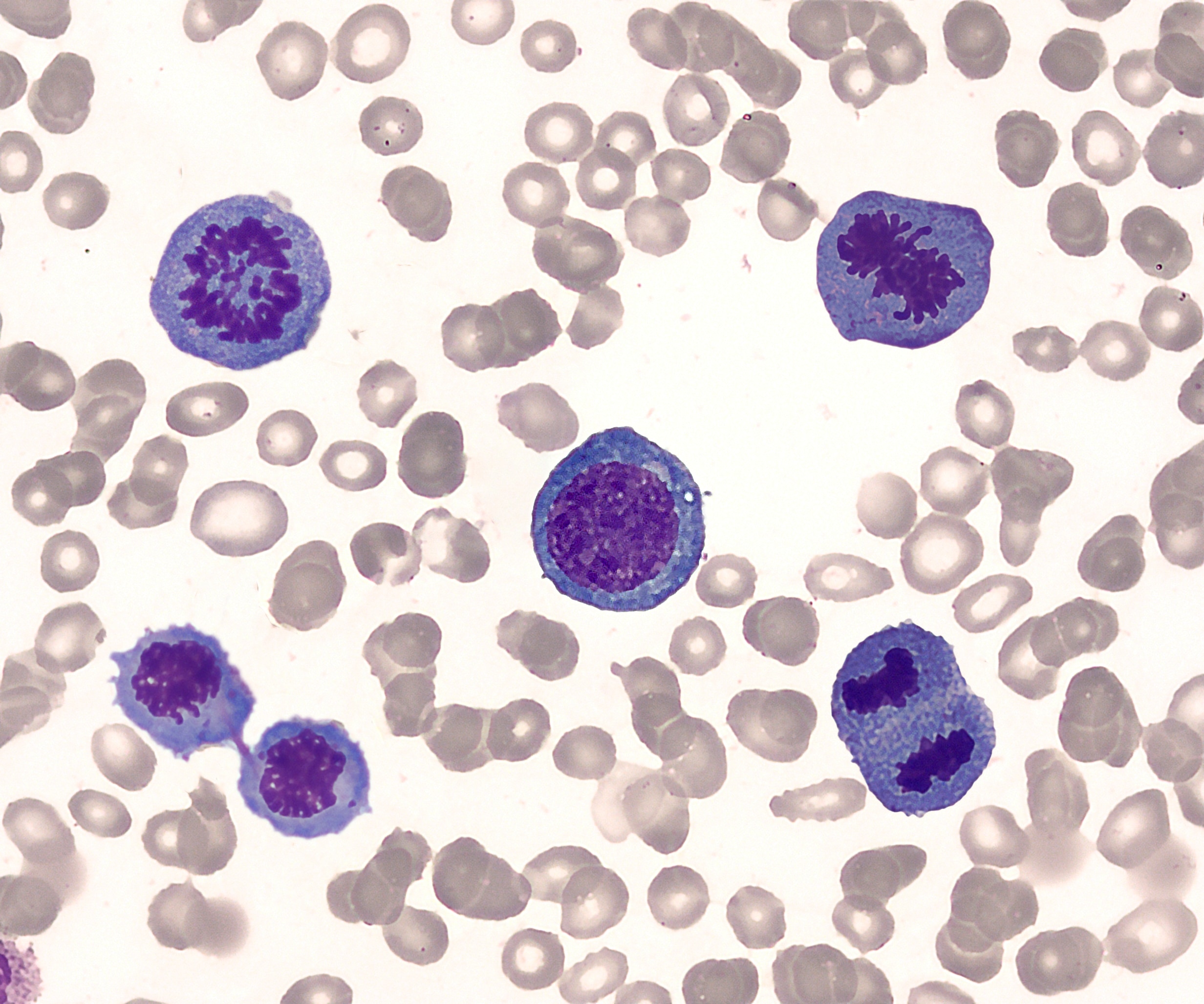 Mitotic Errors | Science and Culture Today